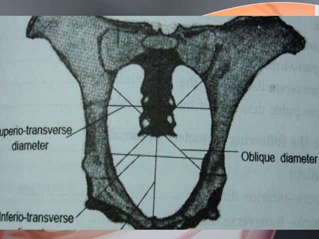 Pelvimetry, pelvic abnormalities,congenital defects of female rep.tract ...
