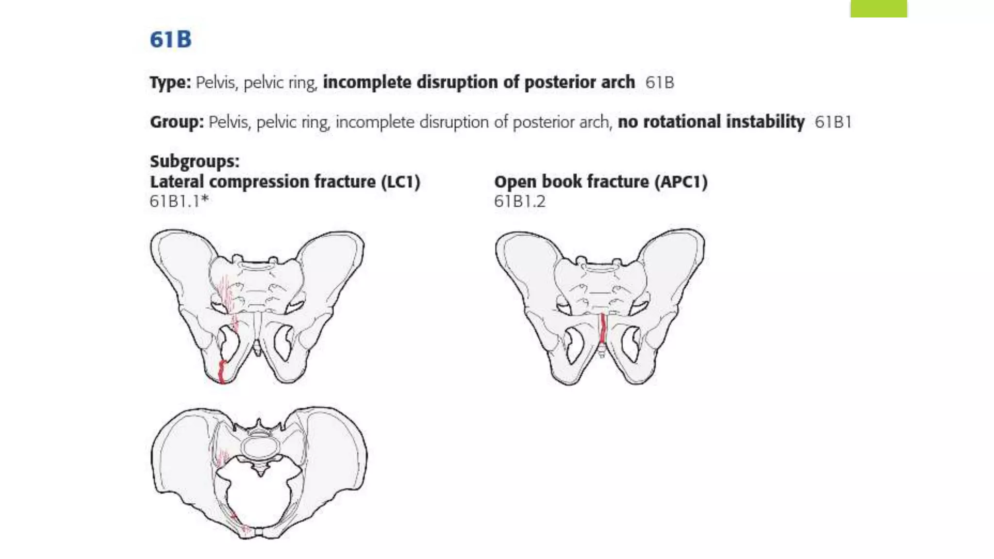 Pelvis fracture dislocation | PPTX