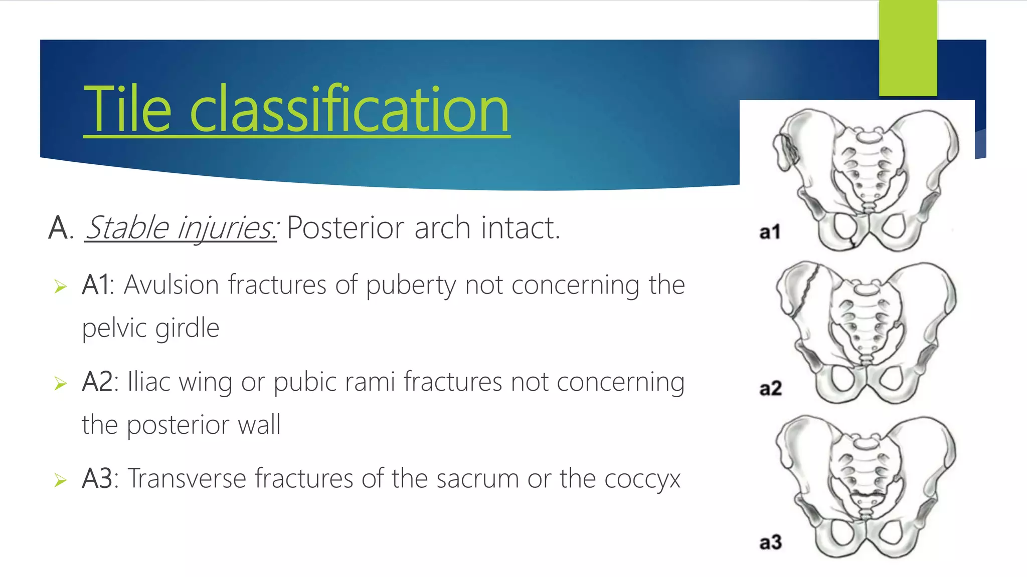 Pelvis fracture dislocation | PPTX