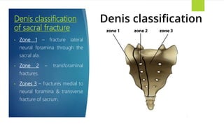 Pelvis fracture dislocation | PPTX