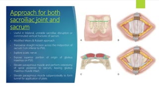 Pelvis fracture dislocation | PPTX