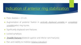 Pelvis fracture dislocation | PPTX