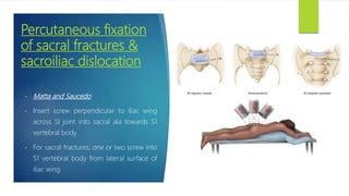 Pelvis fracture dislocation | PPTX