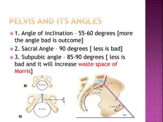 Pelvis - Obstetrical Significance | PPTX