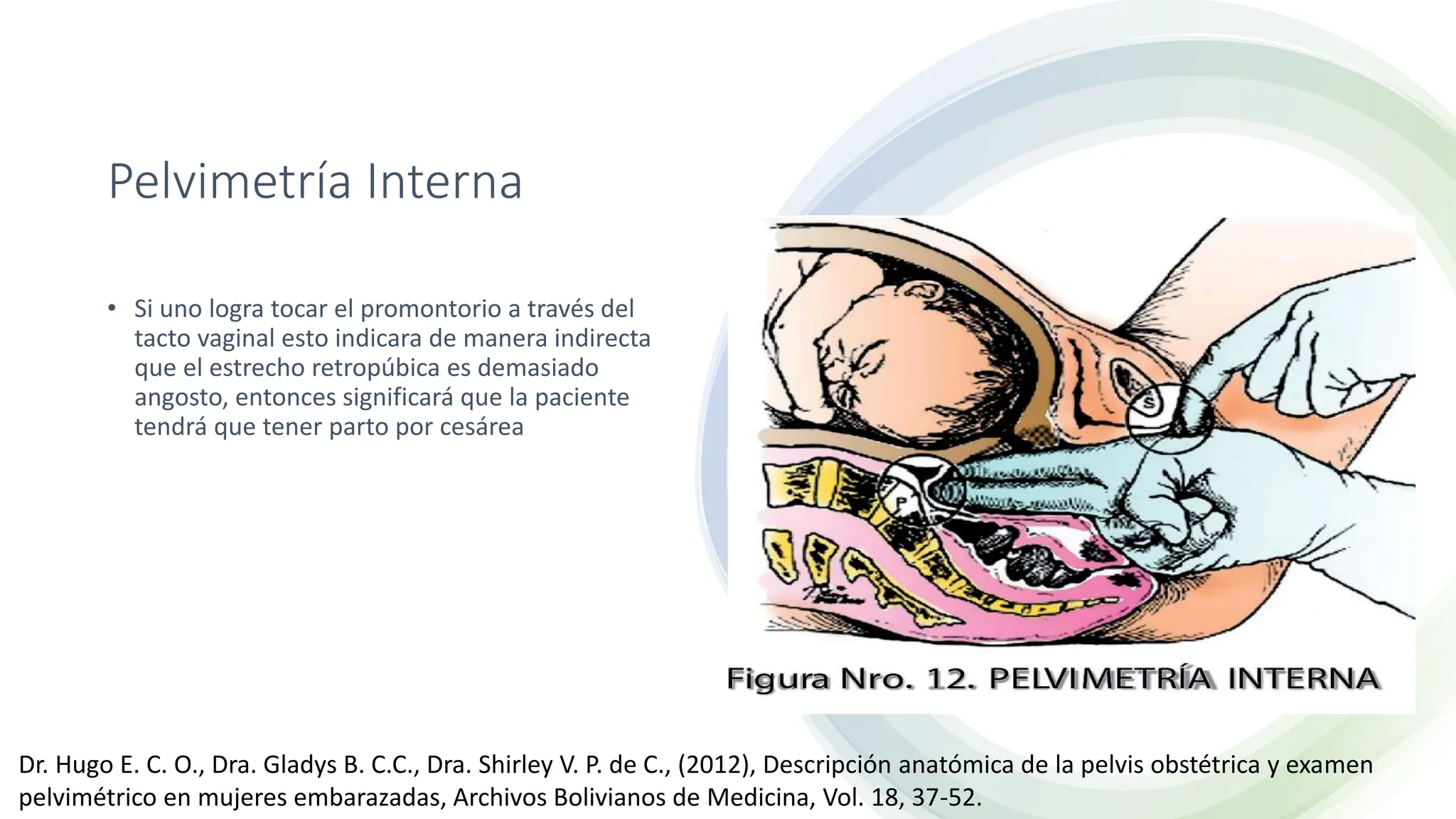 Pelvis Pelvimetria En La Gestante De Término Ppt