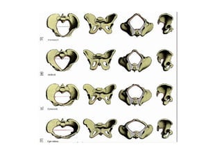 Pelvis.anatomy and types and diameters of pelvis | PPTX