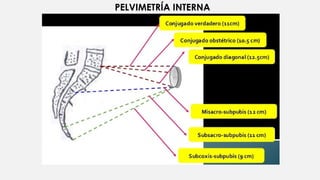 ANATOMIA RADIOLOGICA DE LA ESTRUCTURA DE LA PELVIS.pptx