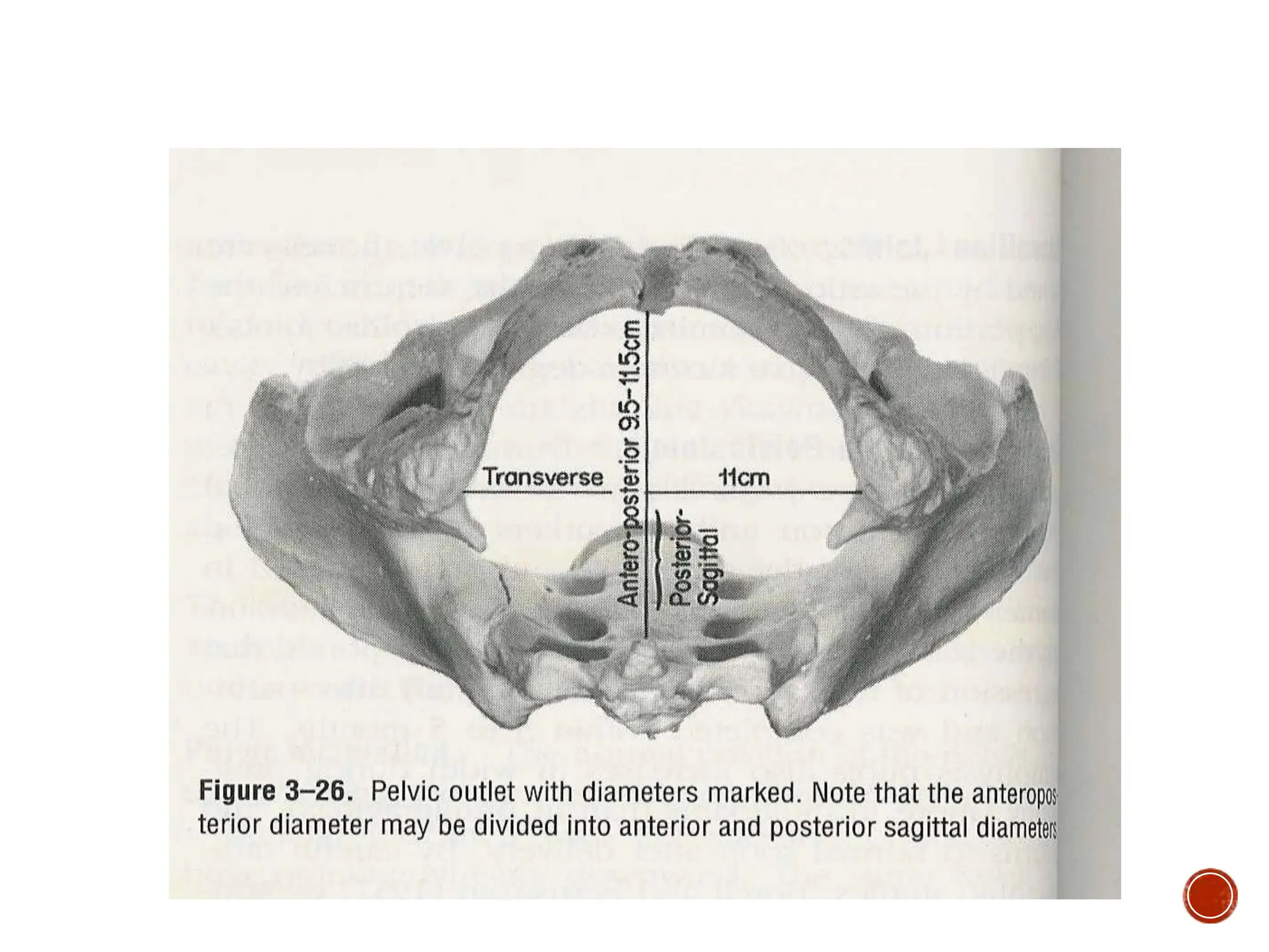 Female PELVIS types of and clinical importance | PPTX
