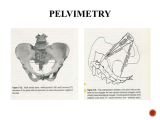 Female PELVIS types of and clinical importance | PPTX