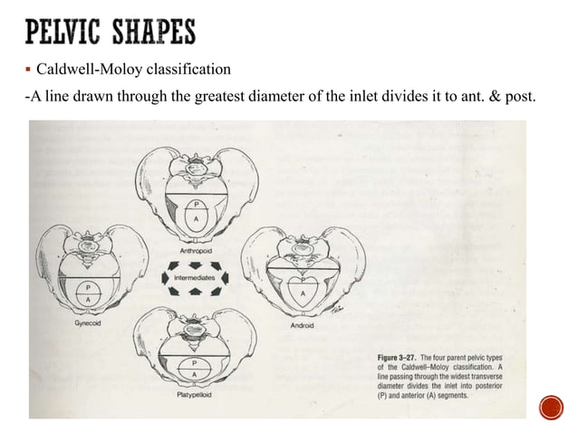 Female PELVIS types of and clinical importance | PPTX | Death, Injury ...