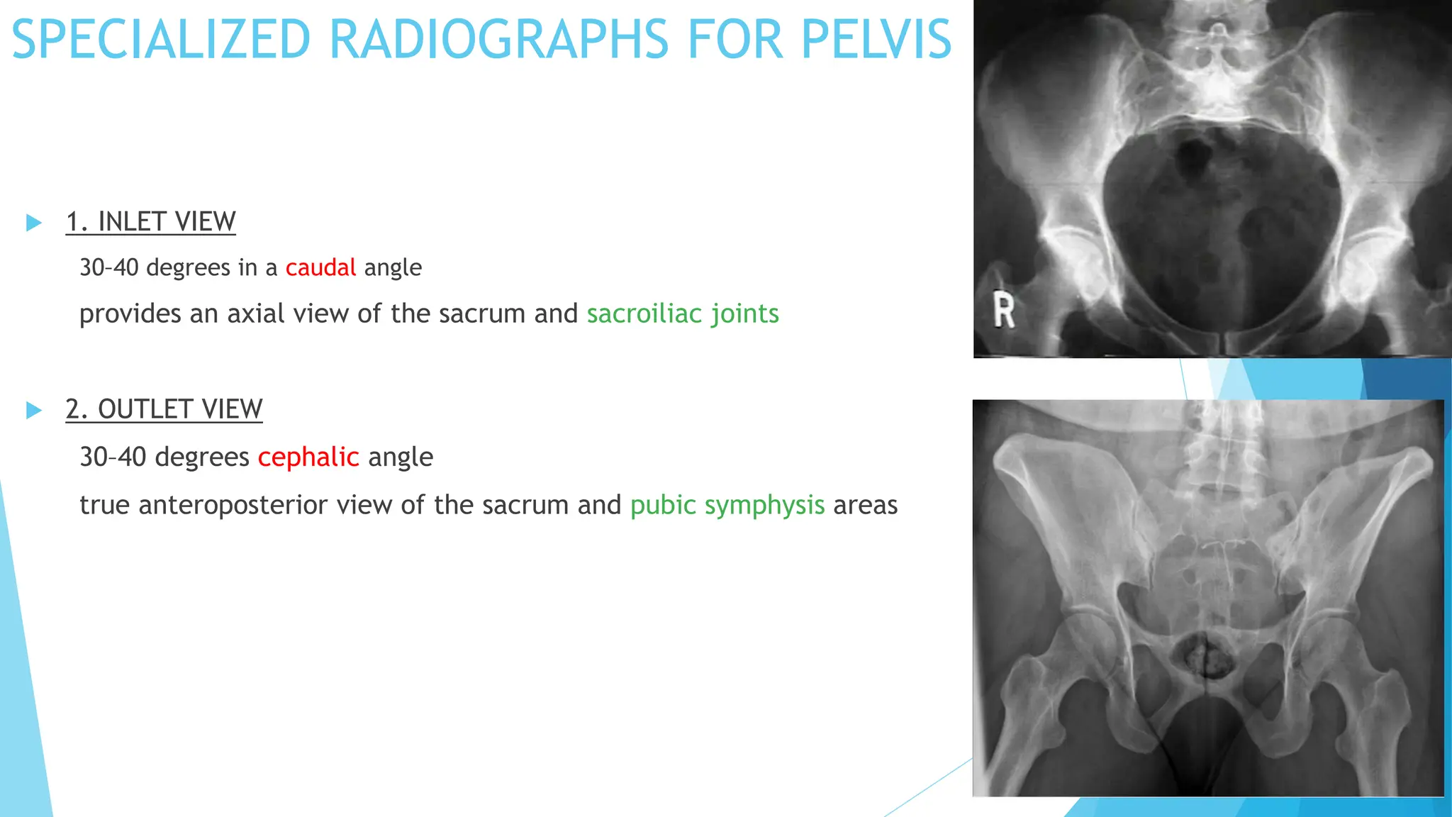 PELVIS & ACETABULUM Orthopaedics topics slides | PPTX