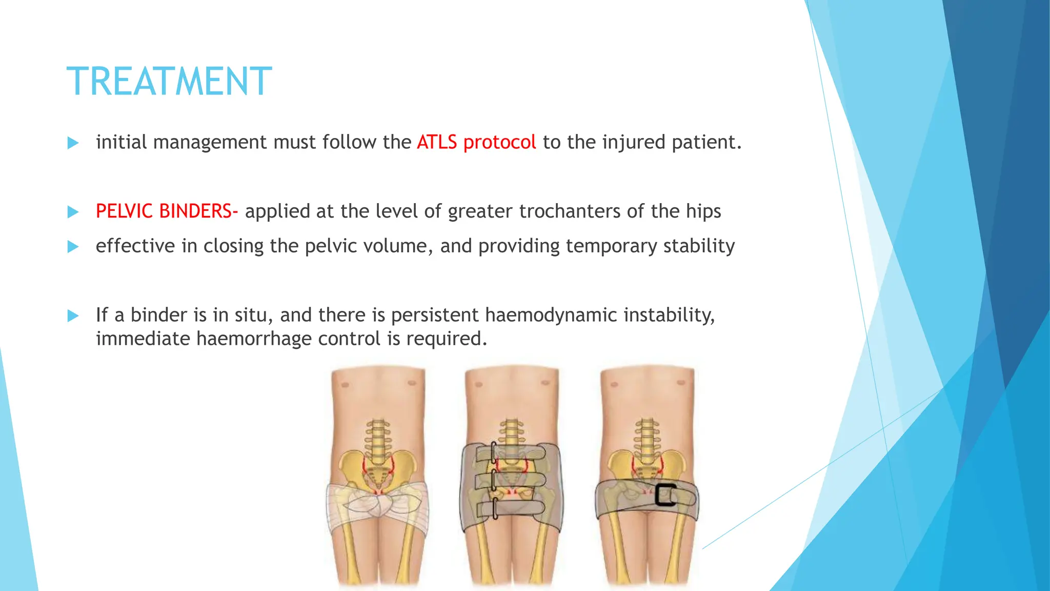 PELVIS & ACETABULUM Orthopaedics topics slides | PPTX