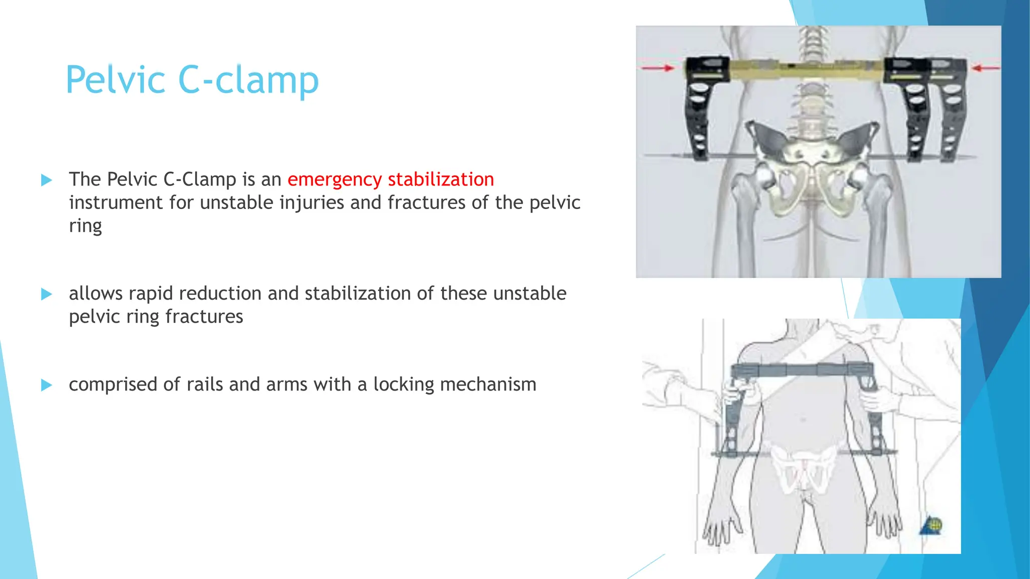 PELVIS & ACETABULUM Orthopaedics topics slides | PPTX