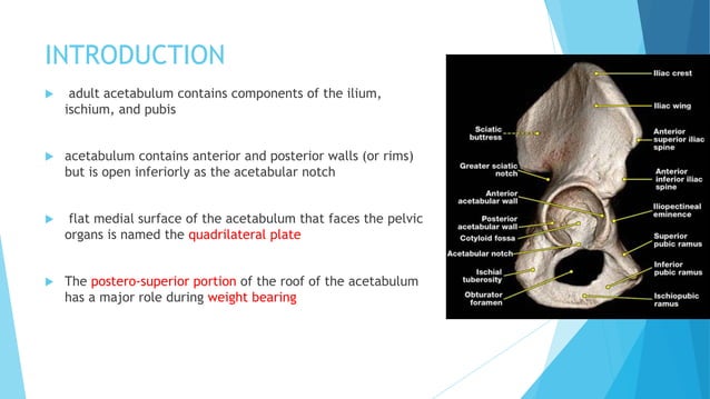 PELVIS & ACETABULUM Orthopaedics topics slides | PPT