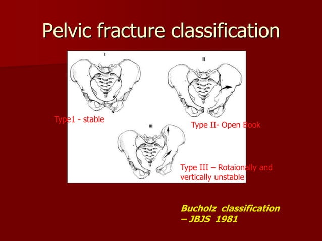 Pelvis acetabulum - anatomy , imaging , classification | PPTX