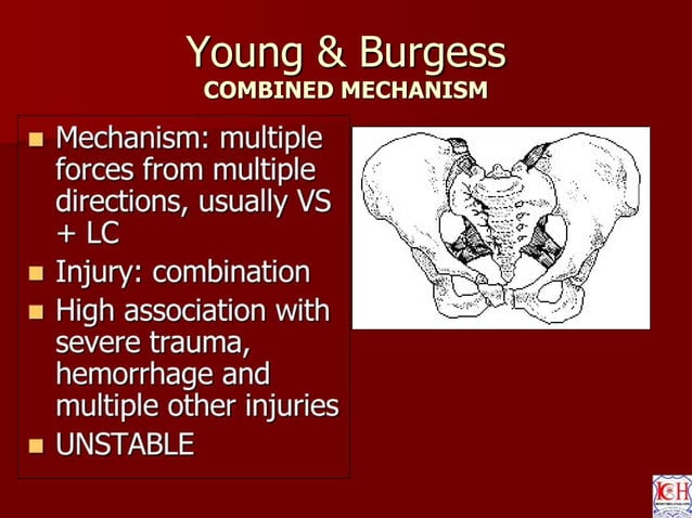 Pelvis acetabulum - anatomy , imaging , classification | PPTX