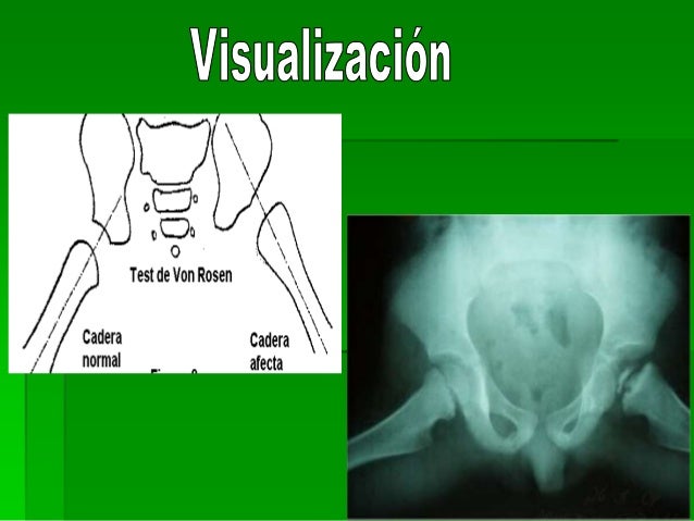 Pelvis alumnos-power