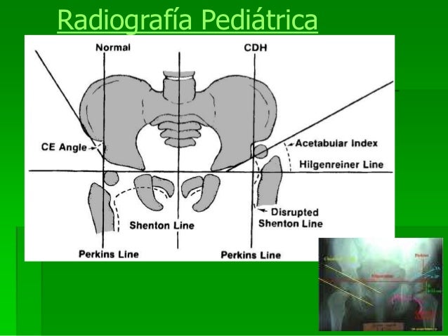 Pelvis alumnos-power