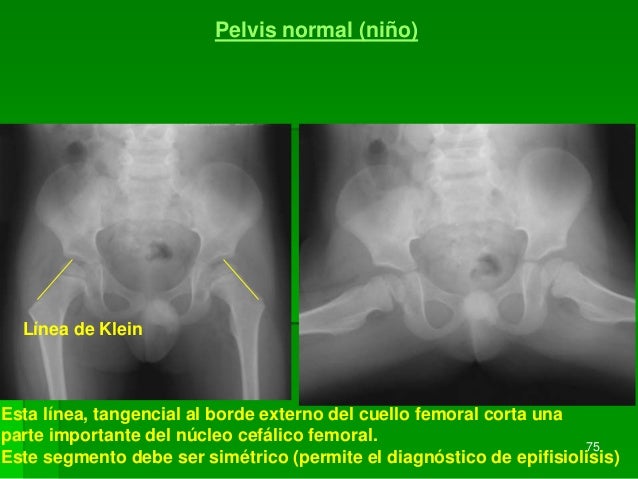 Pelvis alumnos-power