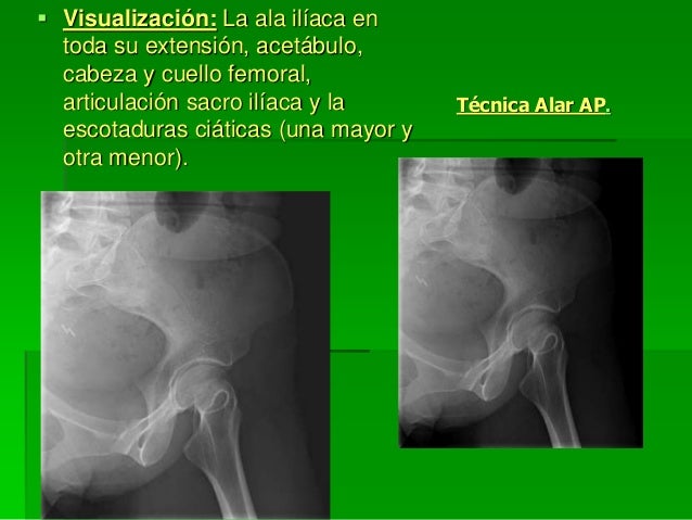 Pelvis alumnos-power