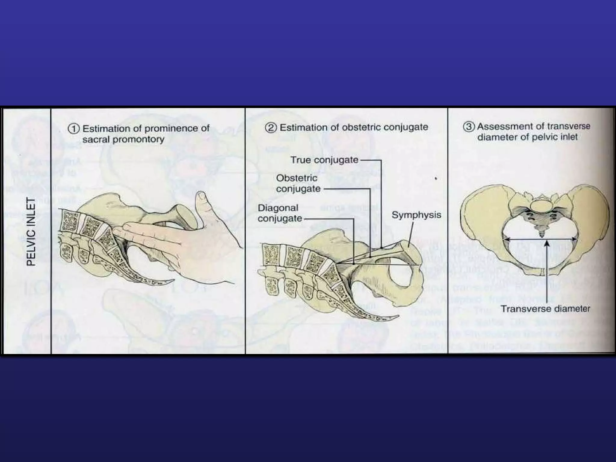 Pelvis and pelvimetry | PPT
