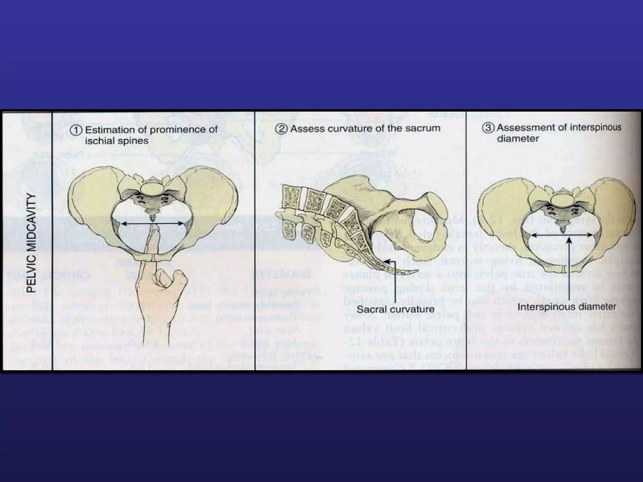 Pelvis and pelvimetry | PPT