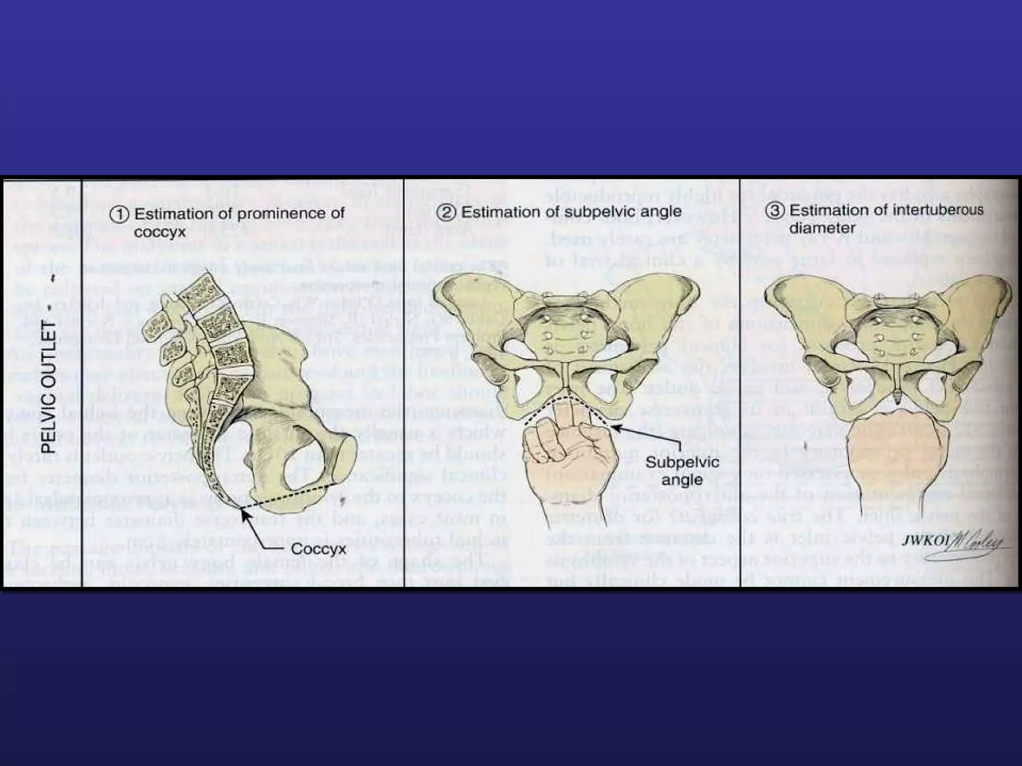 Pelvis and pelvimetry | PPT