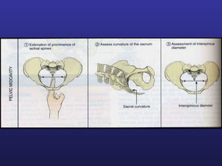 Pelvis and pelvimetry | PPT