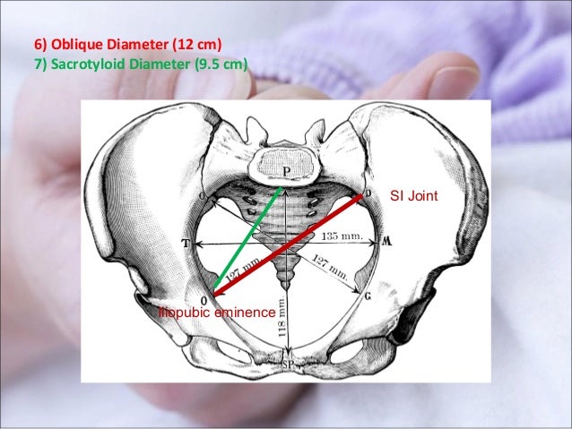 Pelvis and pelvimetry