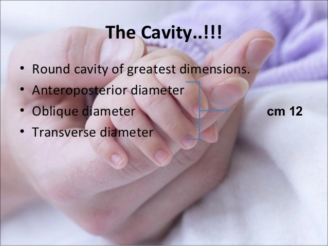 Pelvis and pelvimetry