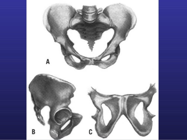 Pelvis and pelvimetry