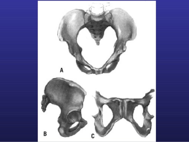 Pelvis and pelvimetry