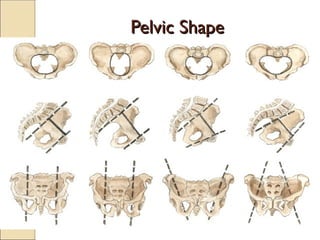 VARIETIES OF PELVIS AND SHAPES OF PELVIS | PPT