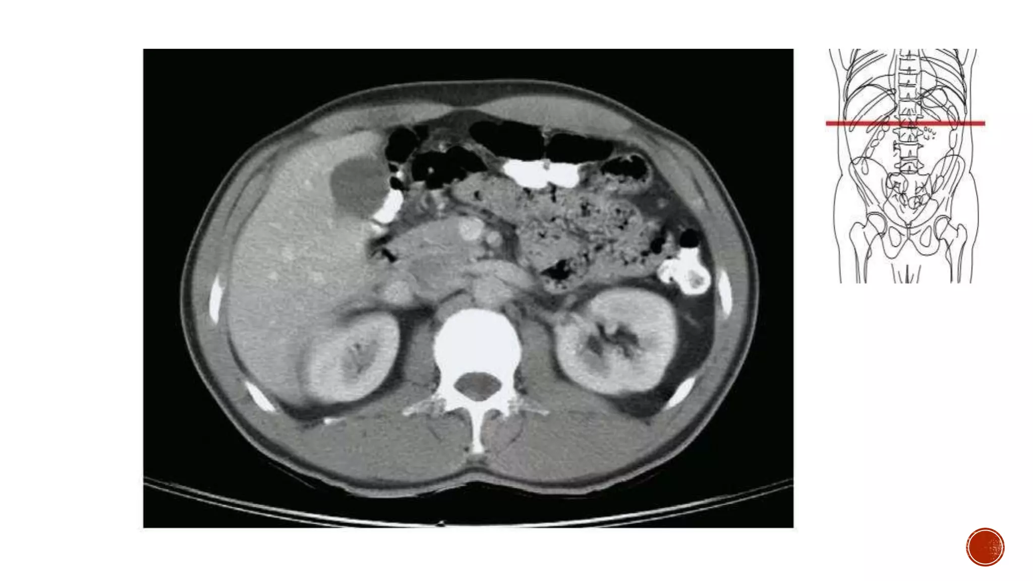 Pelvis cross section anatomy | PPTX