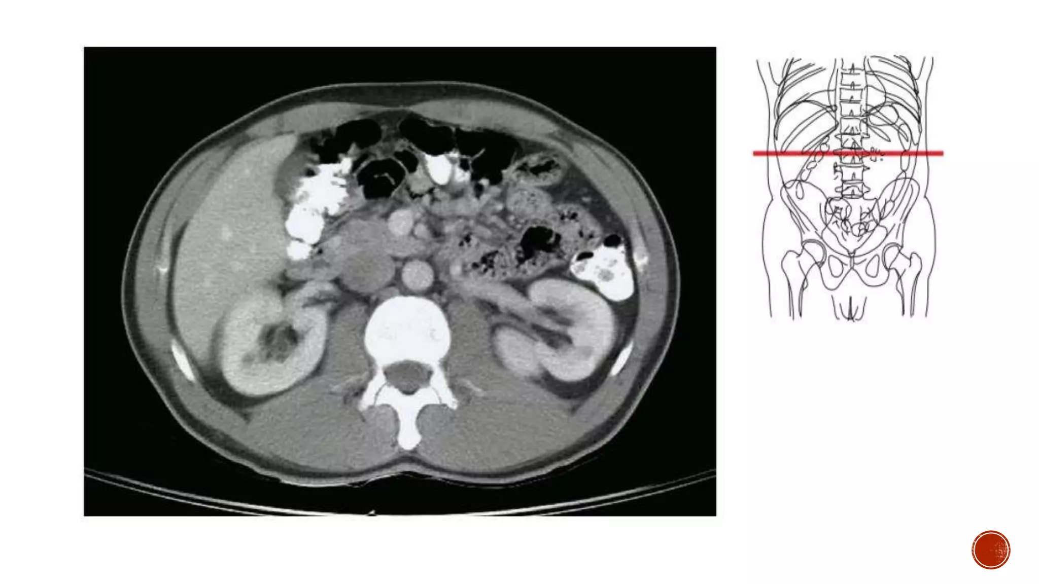 Pelvis cross section anatomy | PPTX