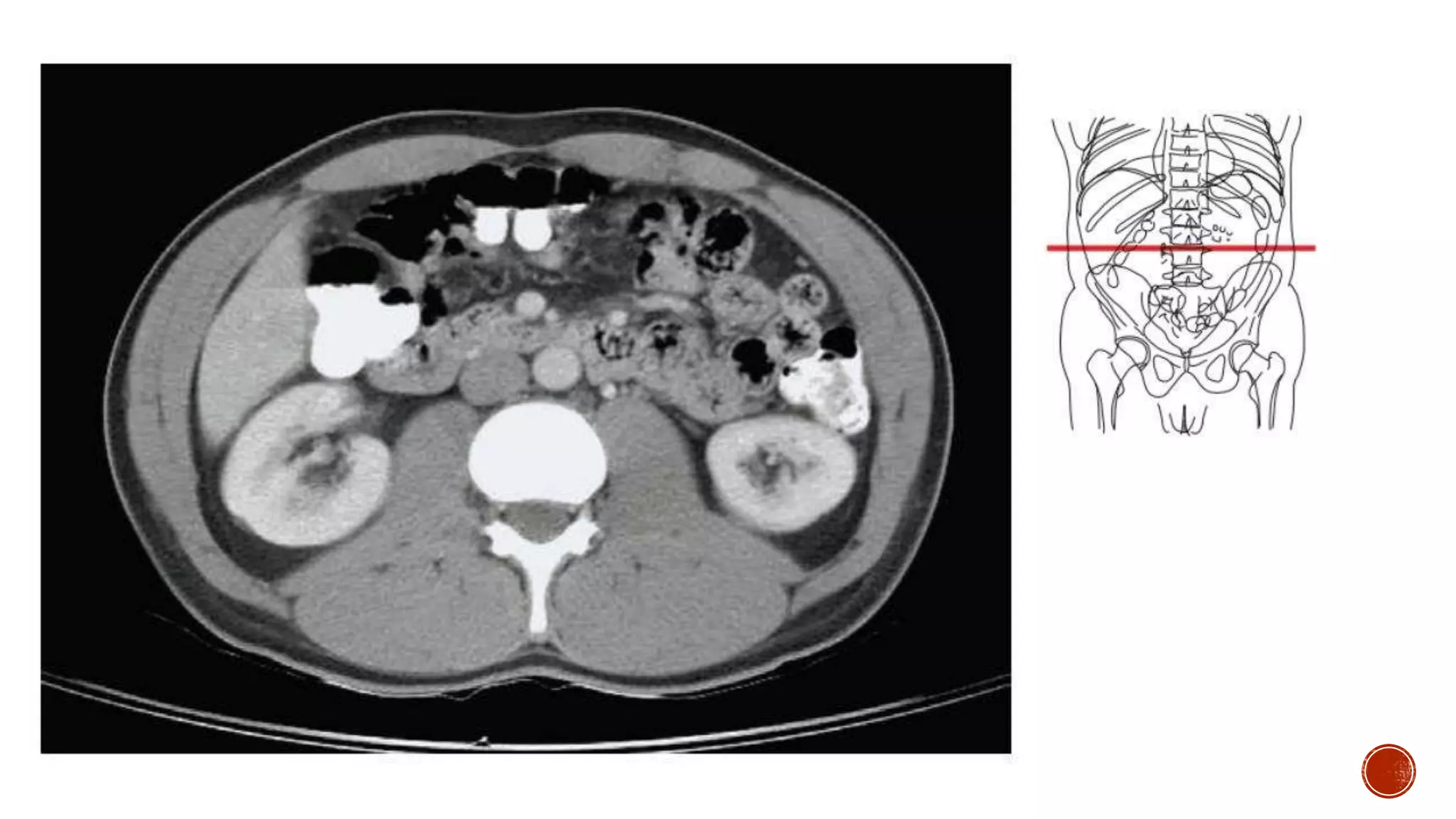 Pelvis cross section anatomy | PPTX