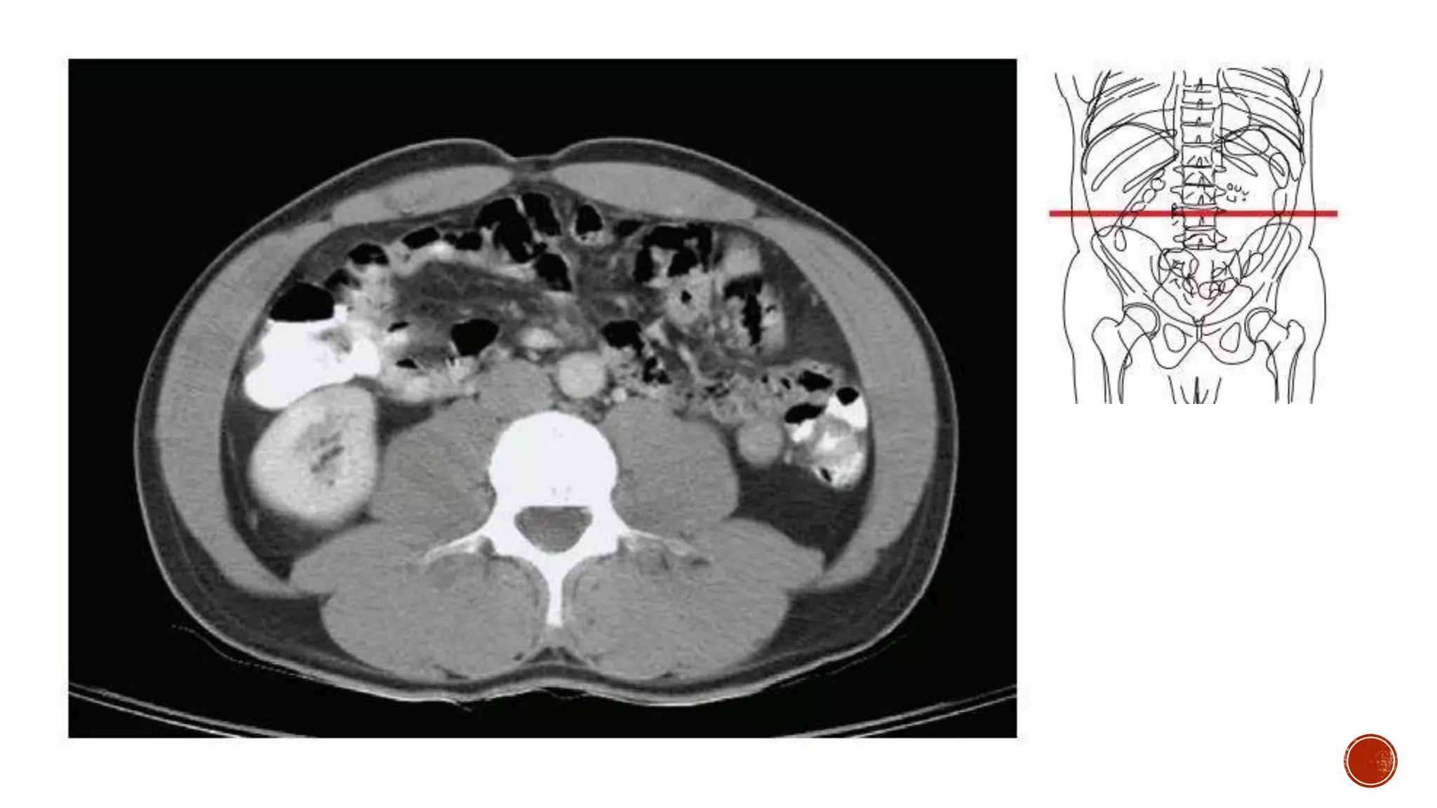 Pelvis cross section anatomy | PPTX