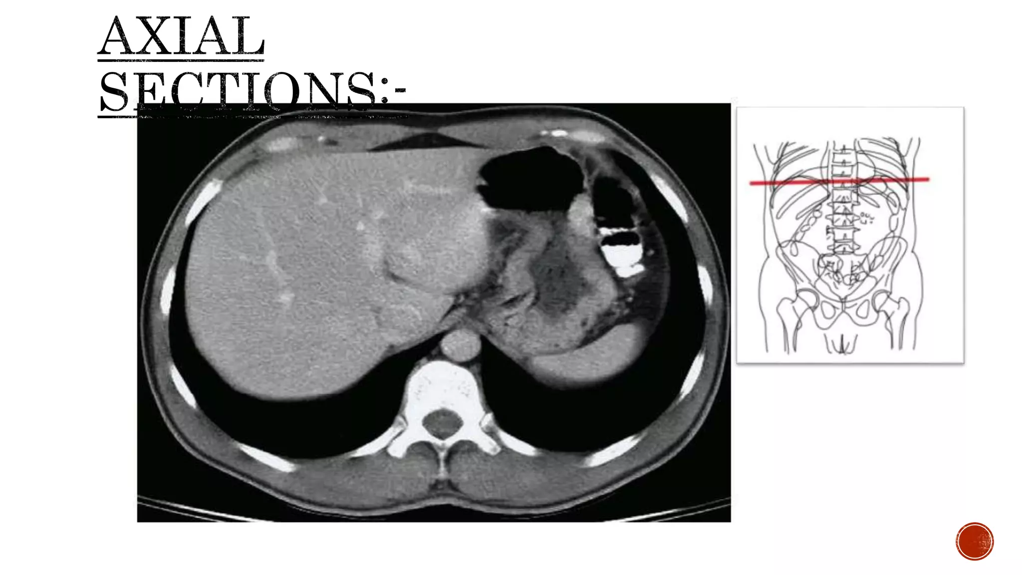 Pelvis cross section anatomy | PPTX