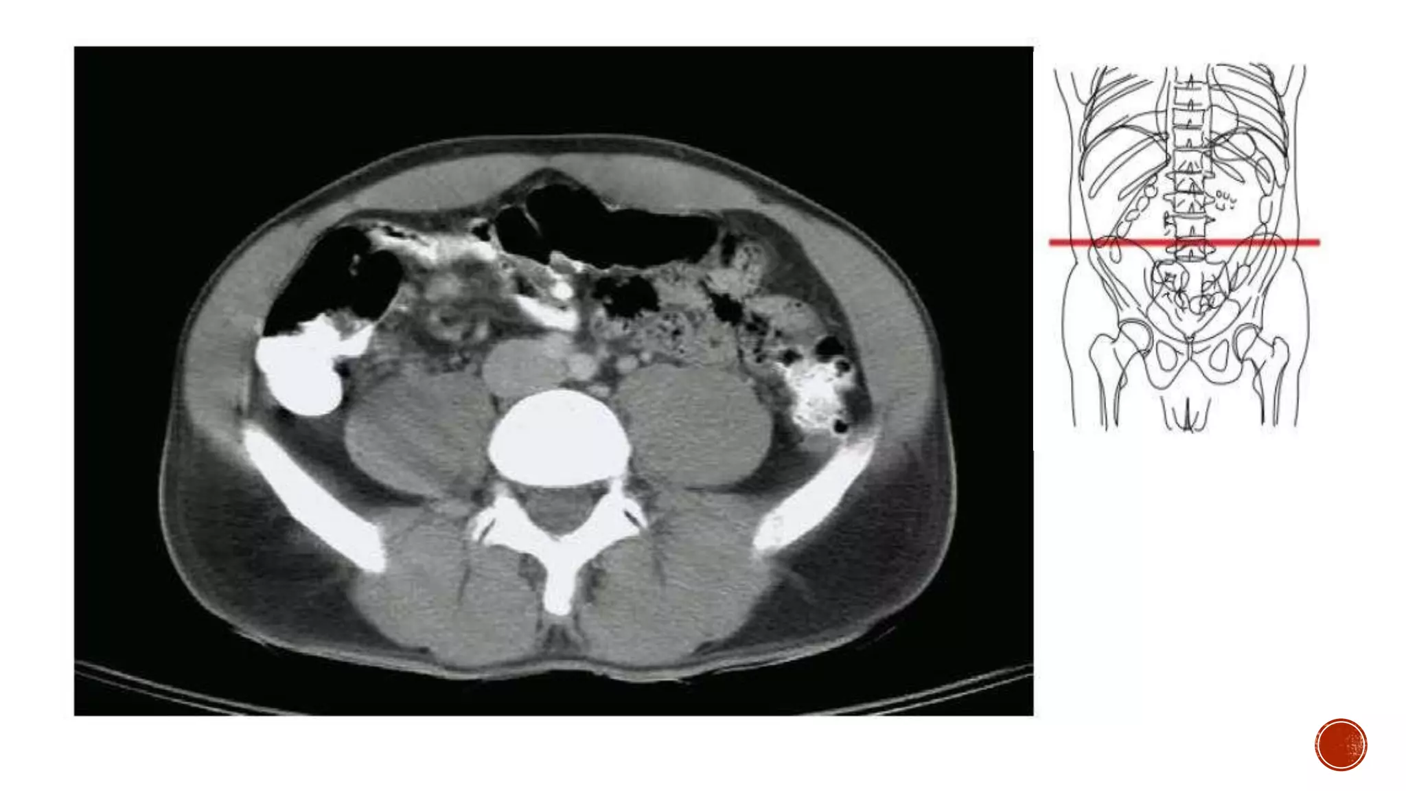 Pelvis cross section anatomy | PPTX