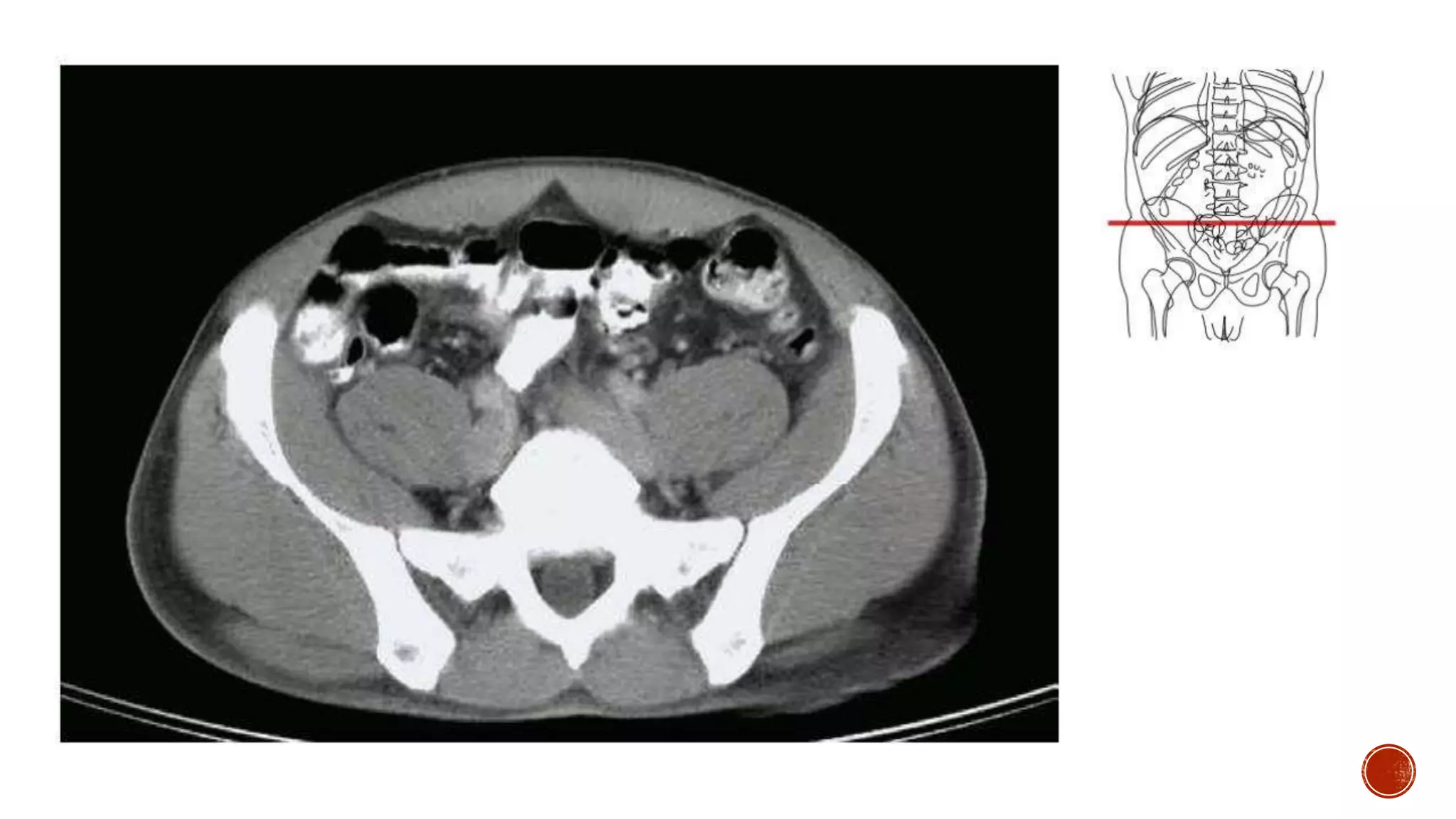 Pelvis cross section anatomy | PPTX
