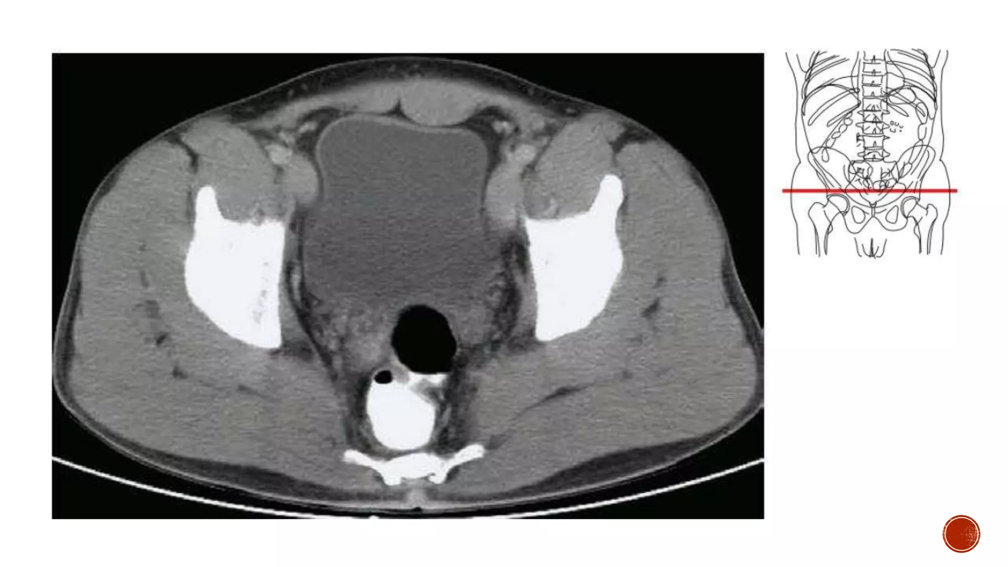 Pelvis cross section anatomy | PPTX