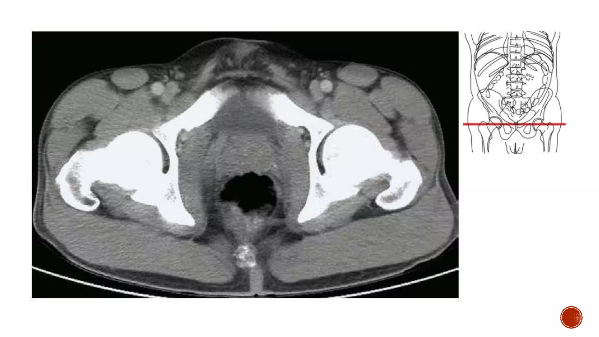 Pelvis cross section anatomy | PPTX