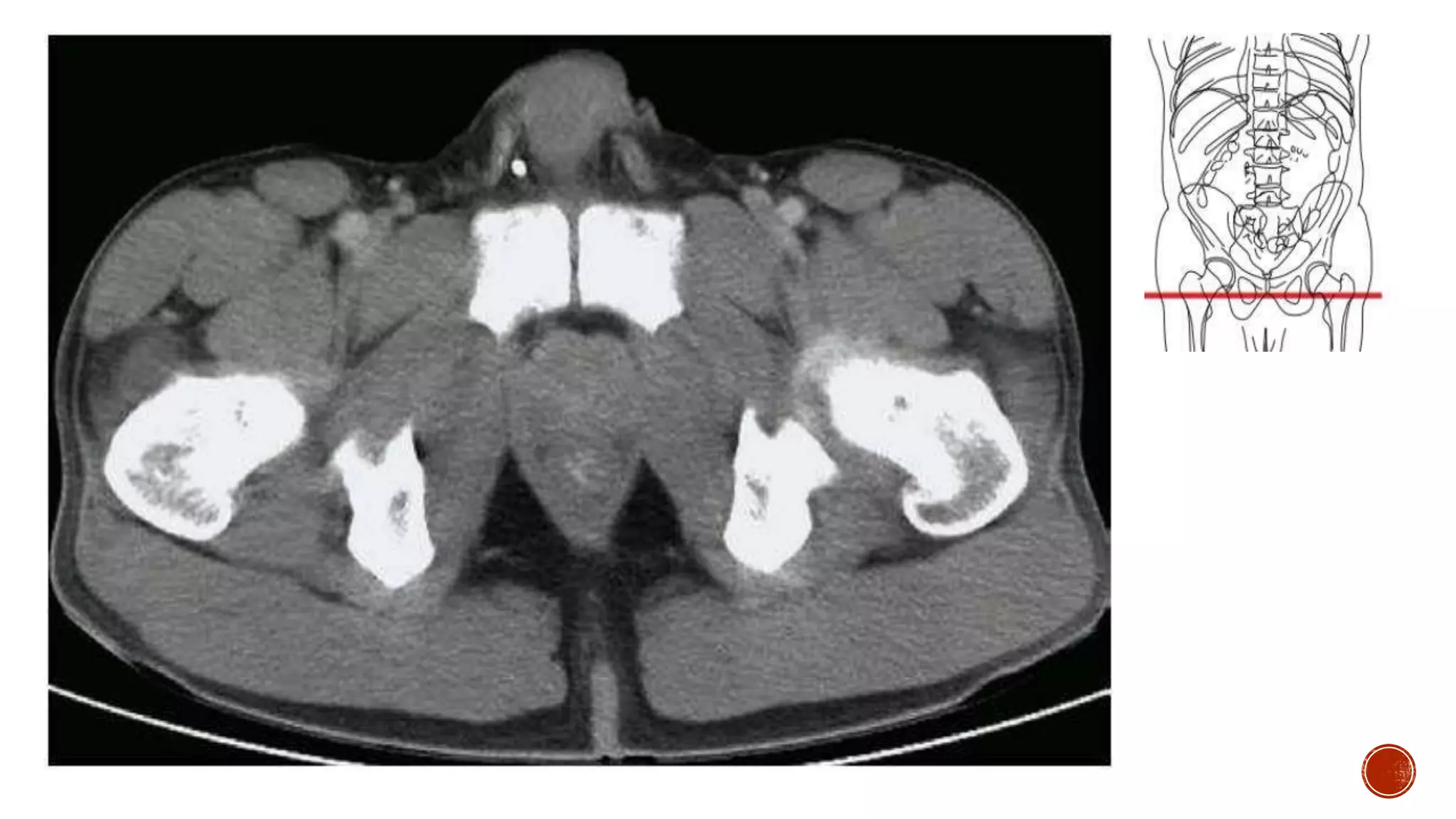 Pelvis cross section anatomy | PPTX