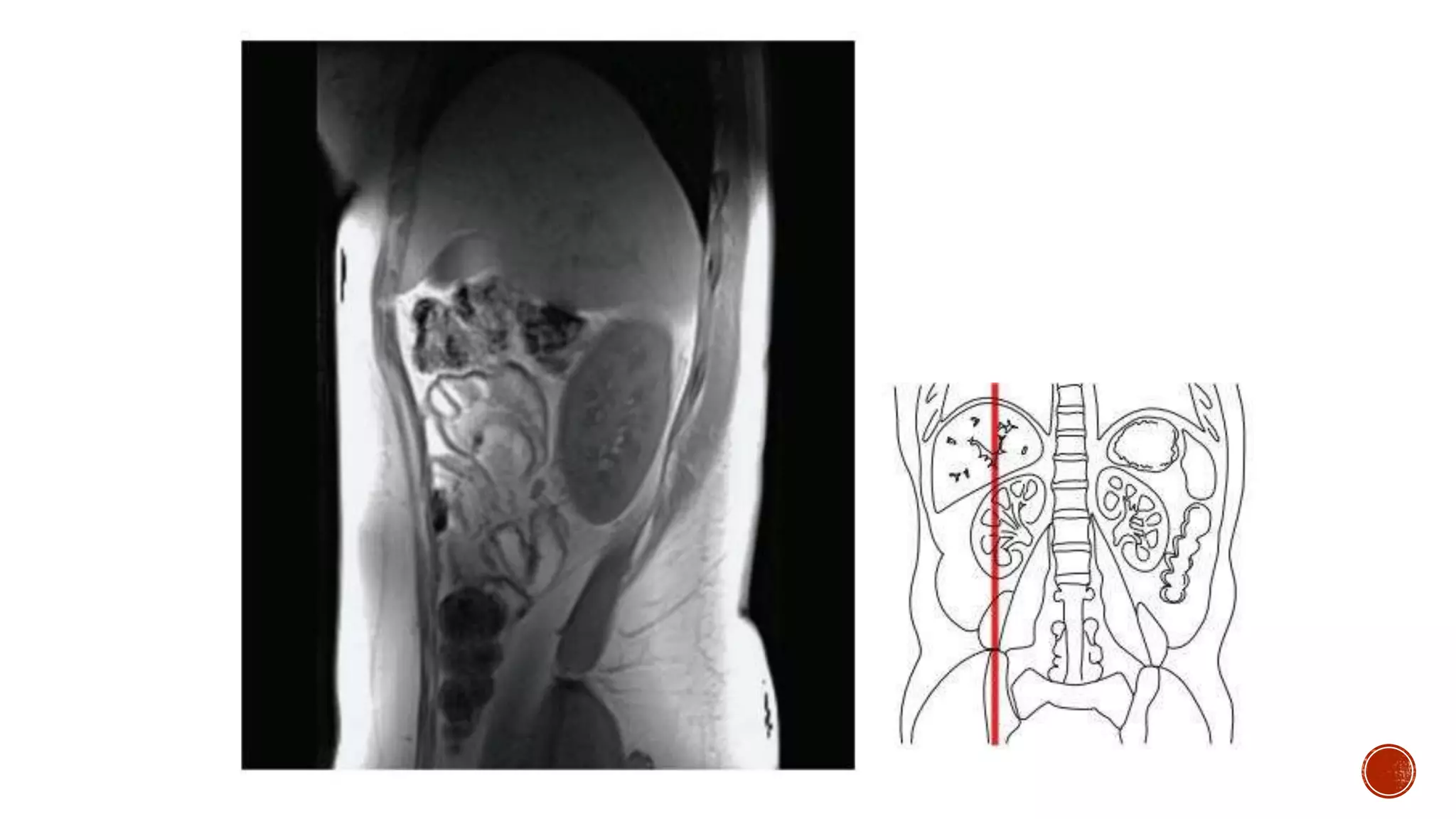Pelvis cross section anatomy | PPTX