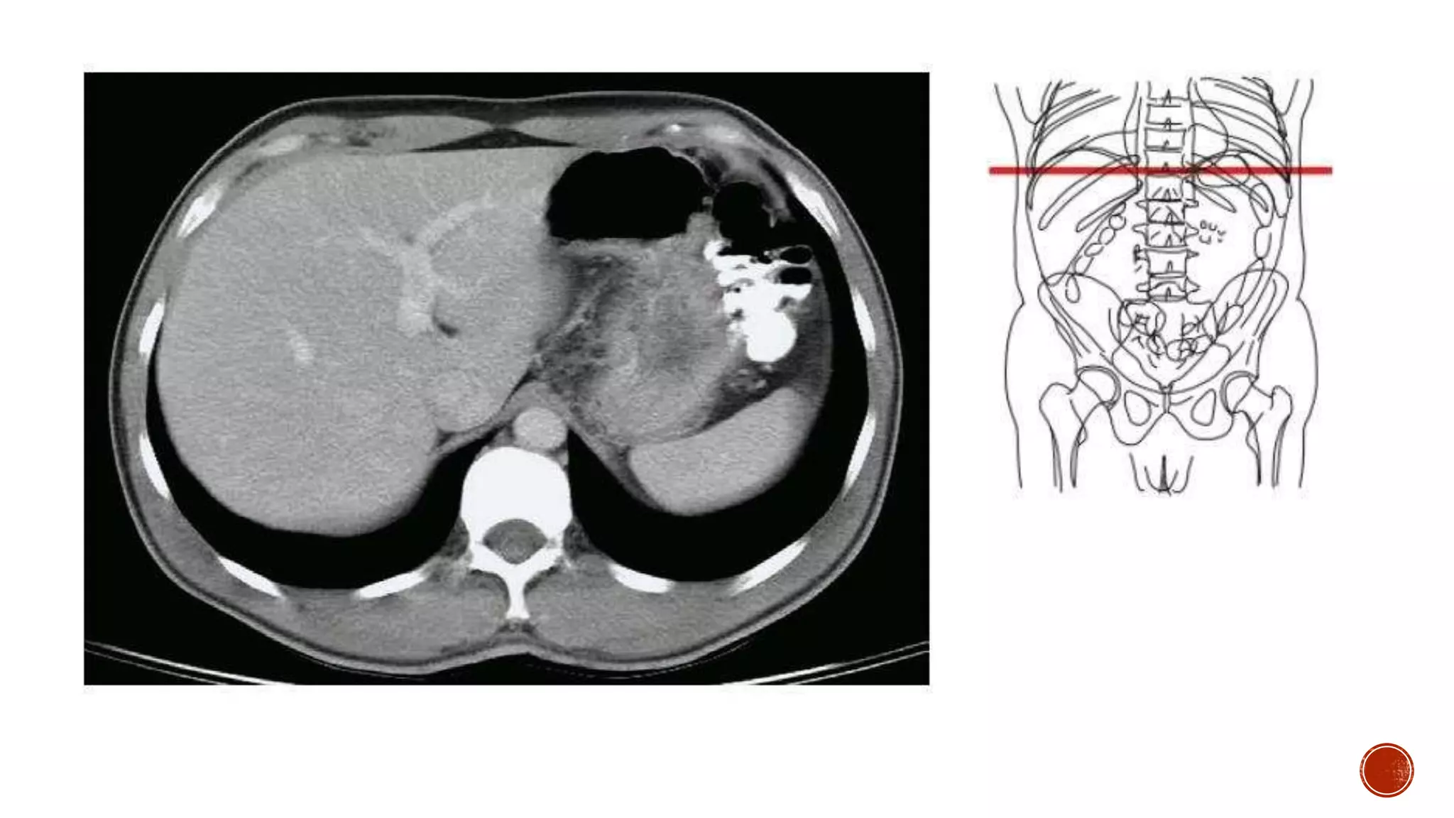 Pelvis cross section anatomy | PPTX