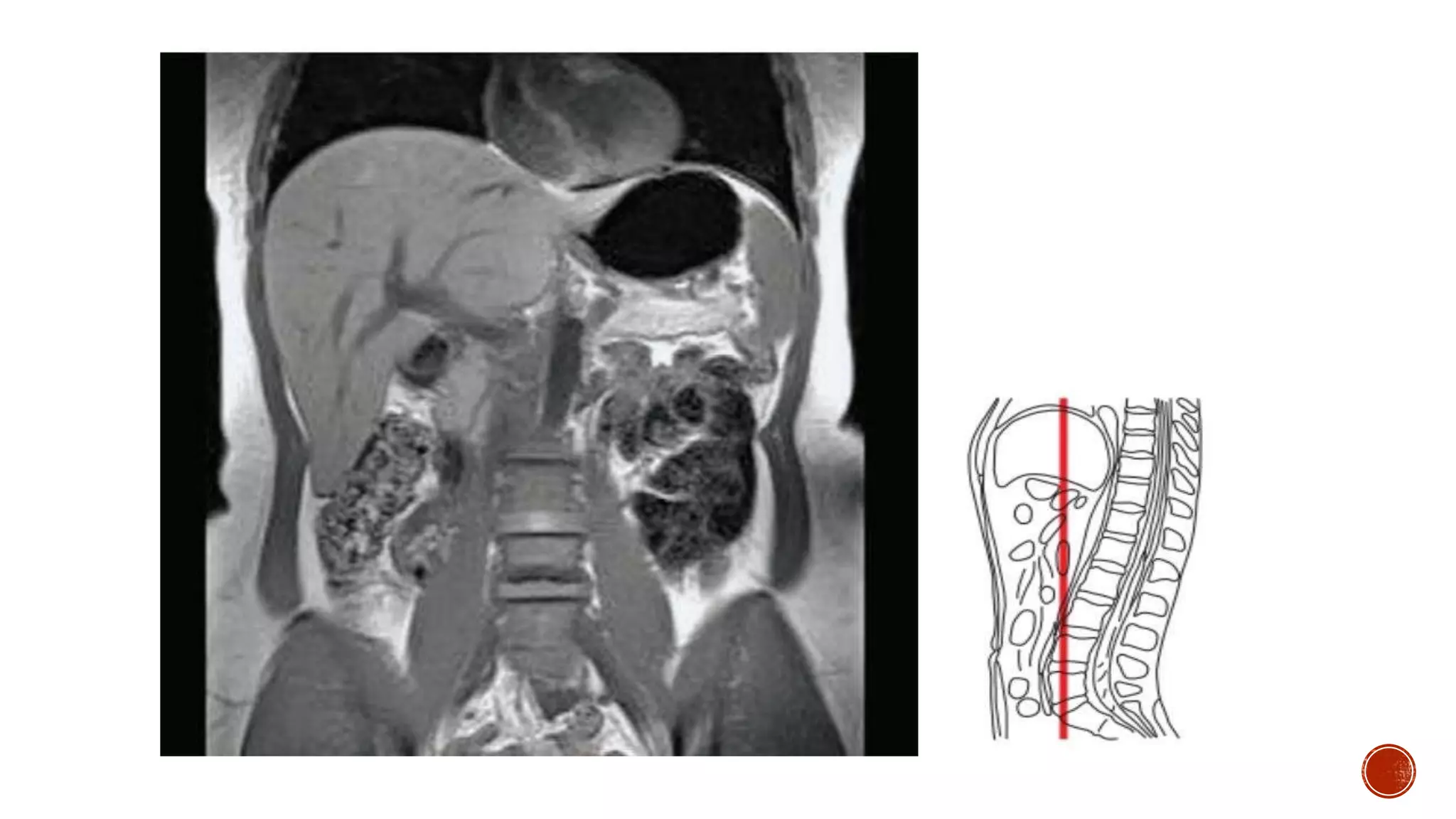 Pelvis cross section anatomy | PPTX