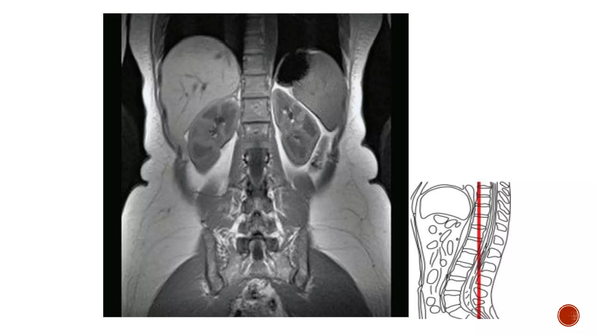 Pelvis cross section anatomy | PPTX