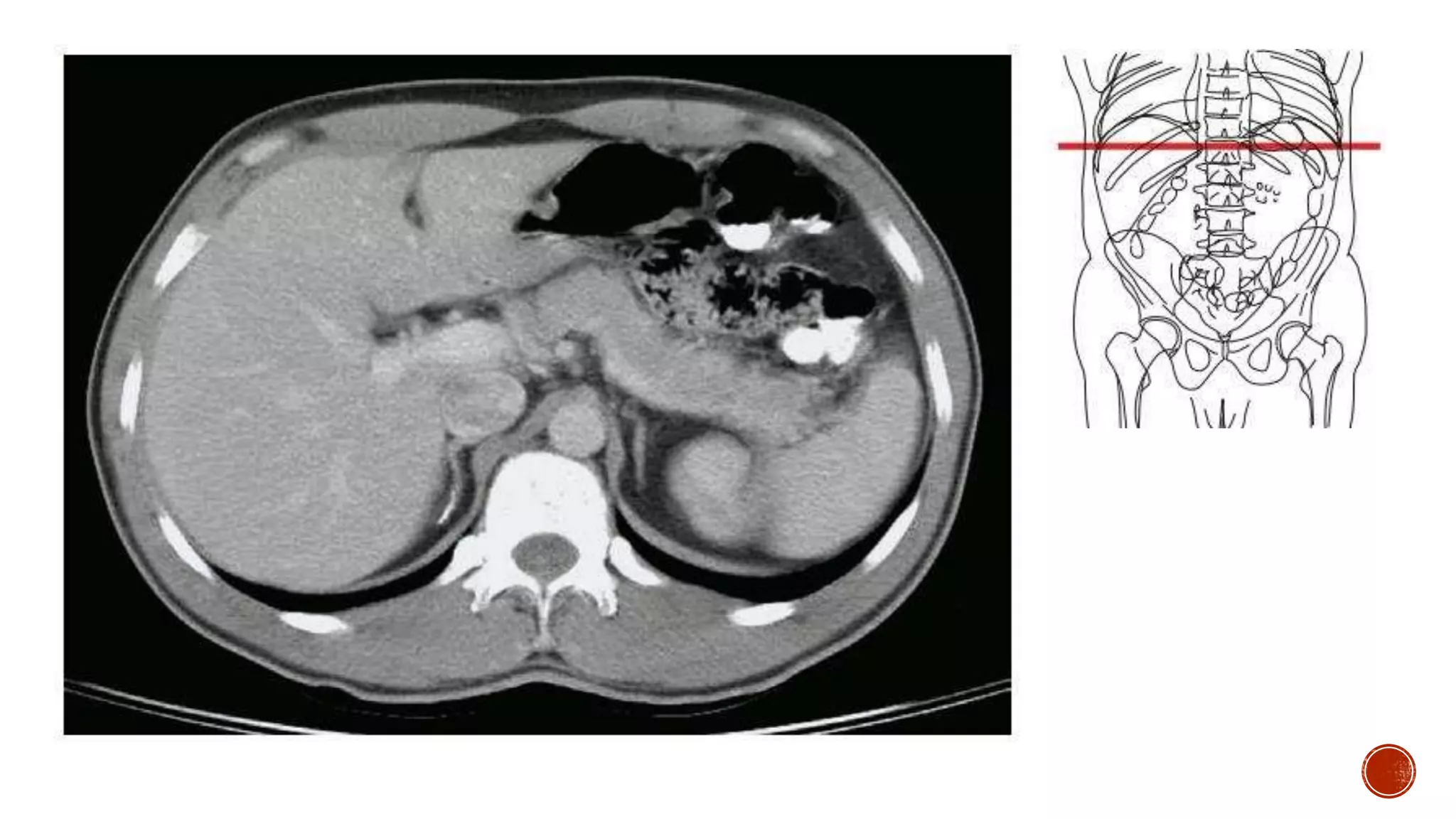 Pelvis cross section anatomy | PPTX