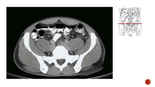 Pelvis cross section anatomy | PPTX