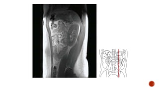 Pelvis cross section anatomy | PPTX